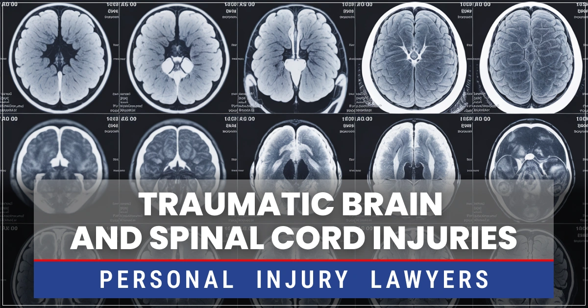 Toronto Brain and Spinal Cord Injury Lawyers | Barapp Law